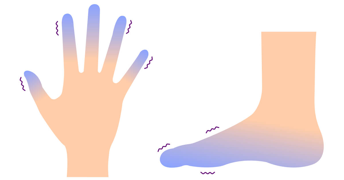 La circulation sanguine des jambes et des bras, comment l'améliorer