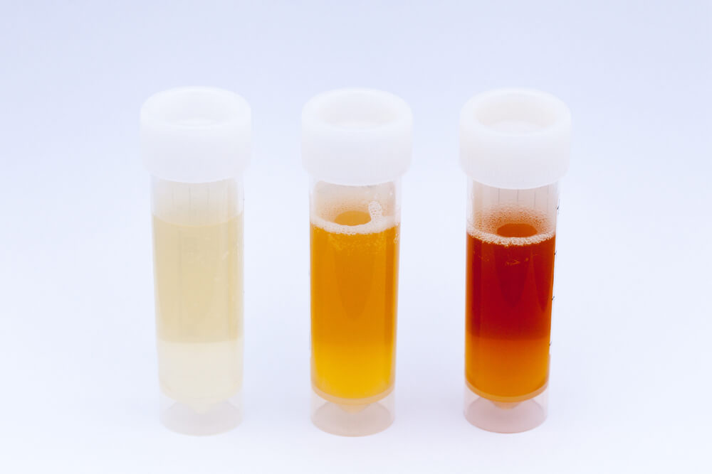 Que dit la couleur de votre urine sur votre santé ? - Améliore ta Santé