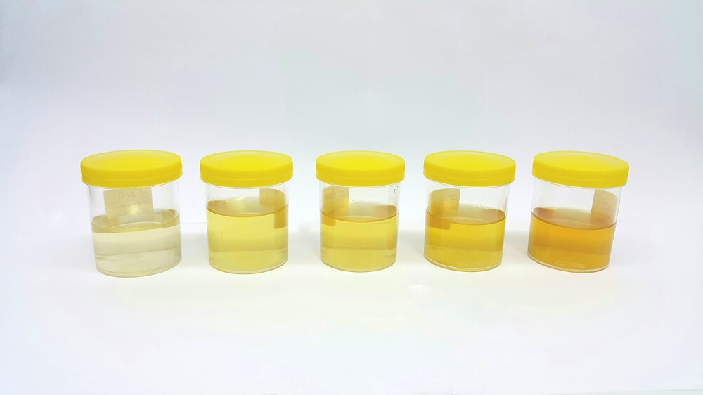 La couleur de votre urine en dit long sur votre santé - Améliore ta Santé