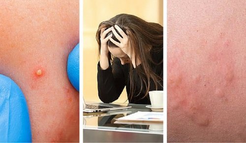 7 symptômes qui indiquent que le stress vous affecte - Améliore ta Santé